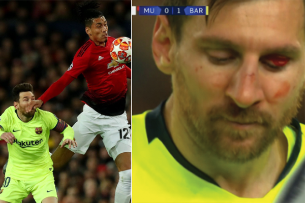 Smalling speaks out on that nasty challenge that left Messi with a ...
